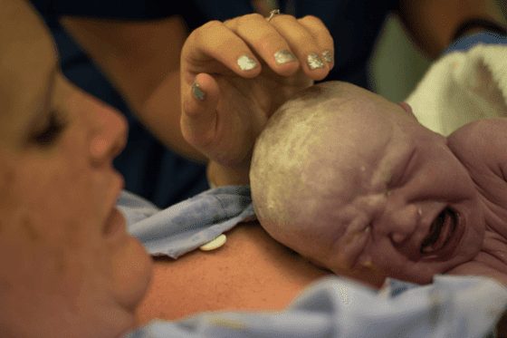 Natural Childbirth vs Epidural: Side Effects and Risks • Kopa Birth®